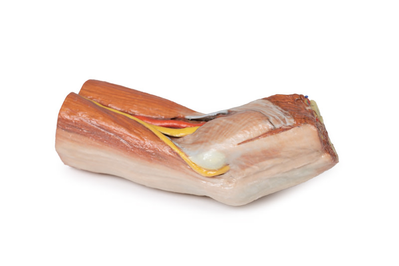 Codo – Fosa cubital - Pranatec Simulación